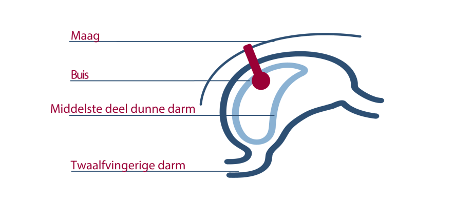 Gastro-jejunostomie | Interventieradiologie AVL